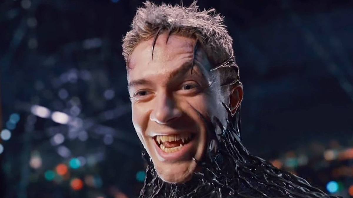 Forget Tom Hardy, Topher Grace Is MY Venom
