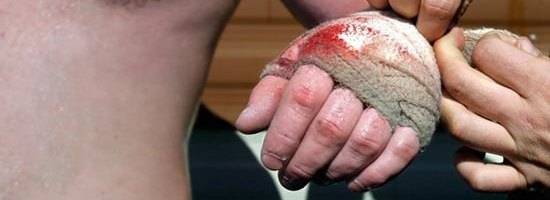 HBO Remaking Sundance Documentary KNUCKLE